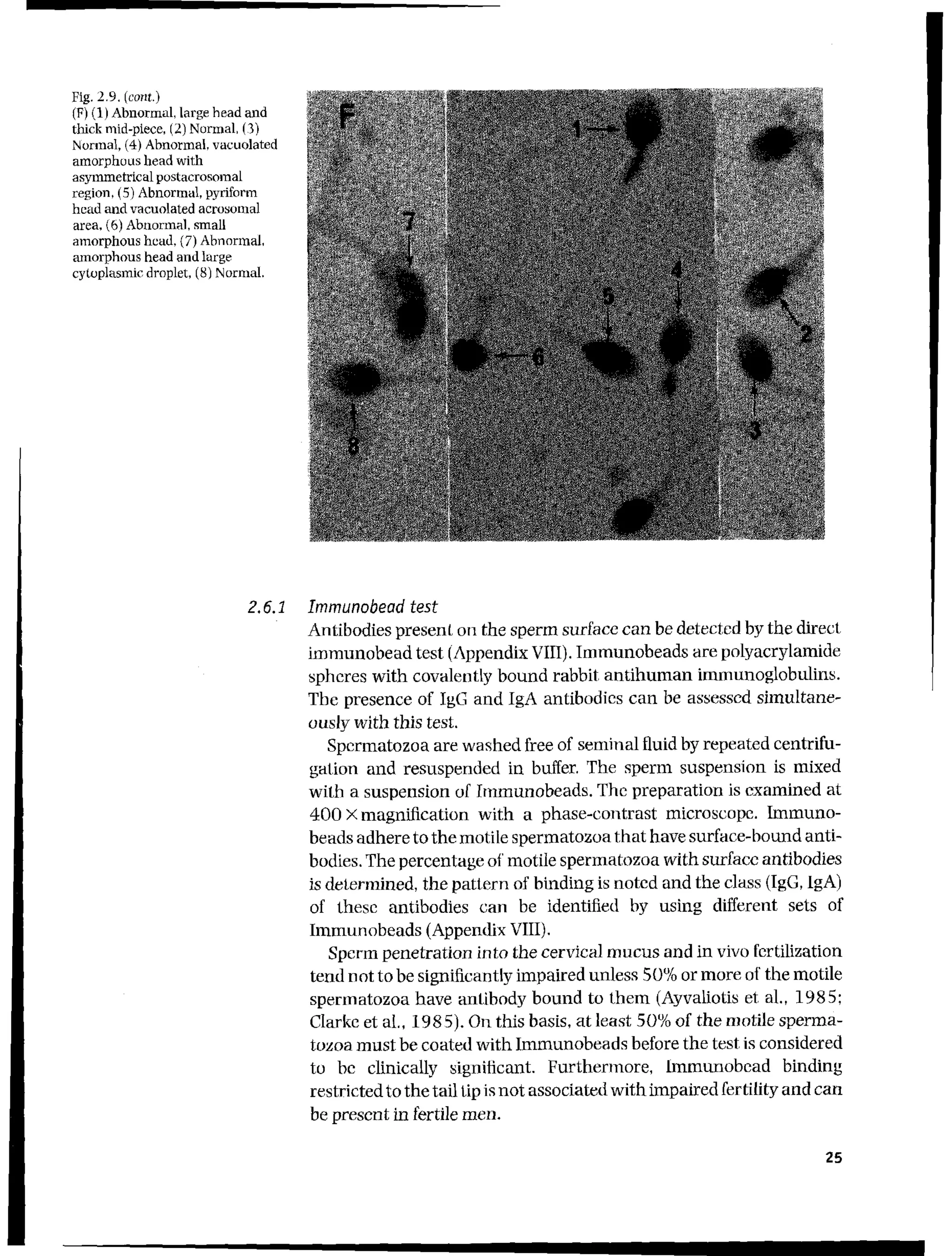 who laboratory manual for the examination of human semen and sperm ...