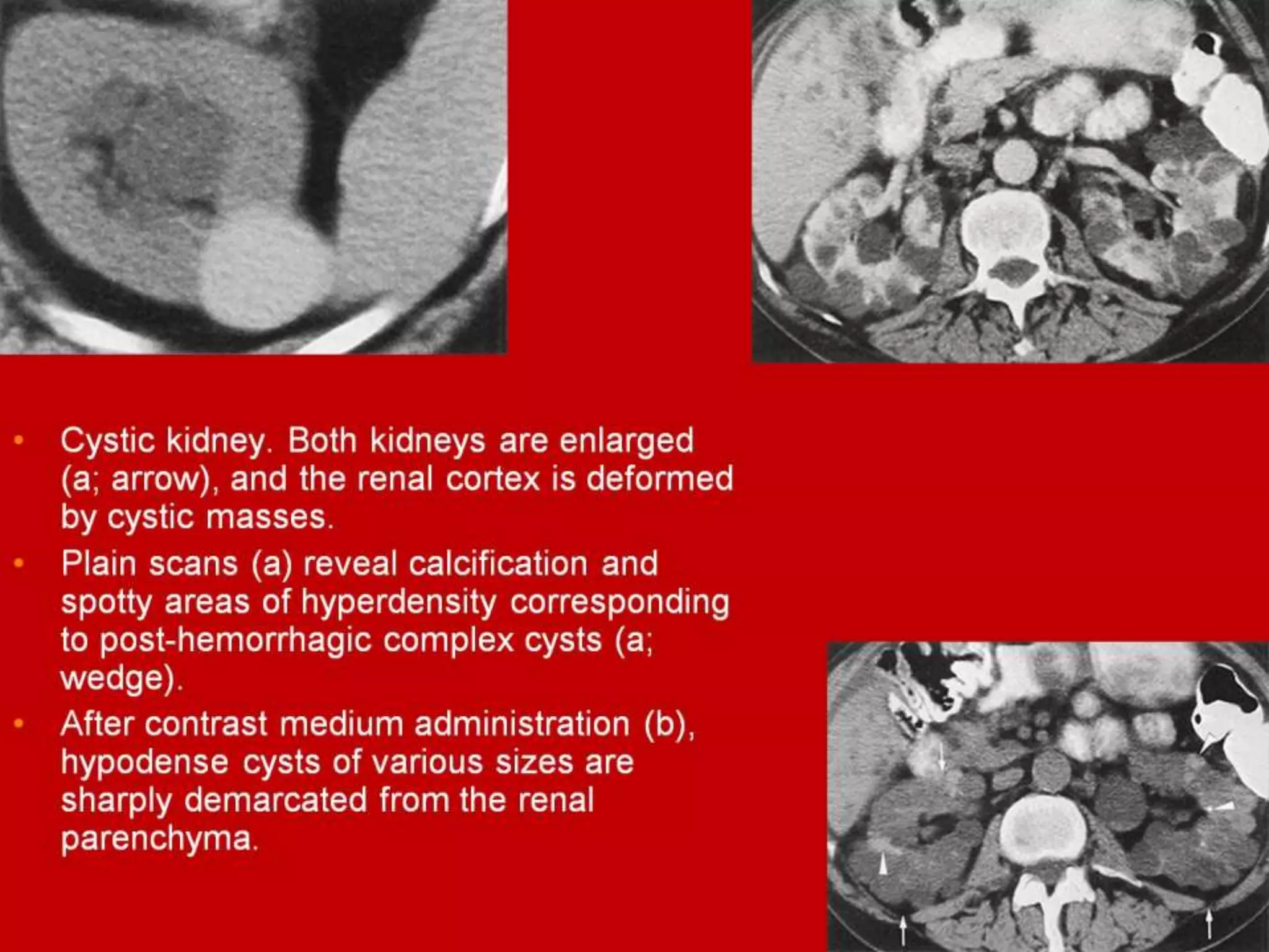 Whole body computed tomography kidney | PPTX