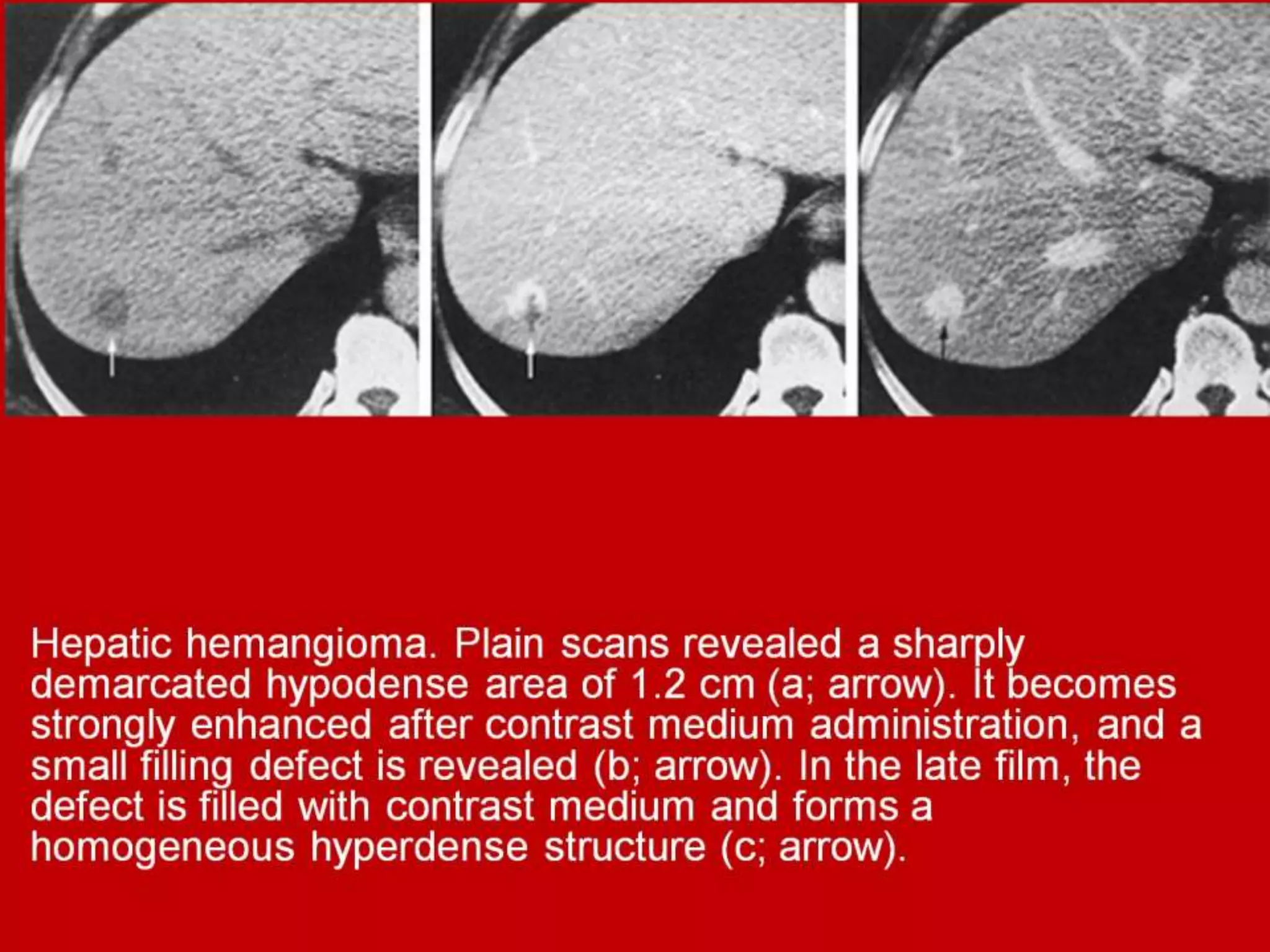 Whole body computed tomography liver | PPT | Free Download