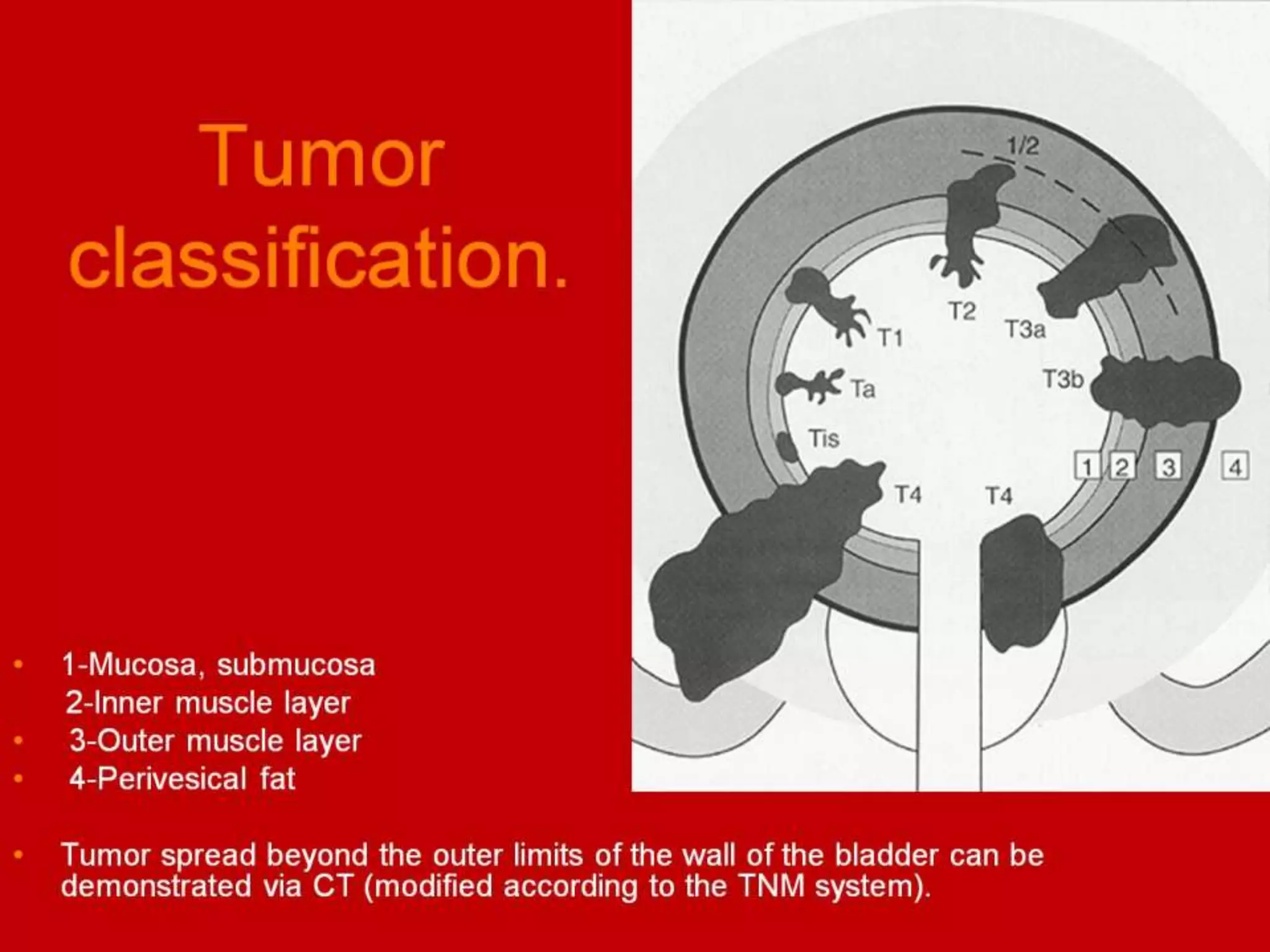 Whole body computed tomography urinary bladder | PPT