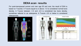 Whole body DEXA scan in Chandigarh-- Sanjivini Diagnostics. | PPTX