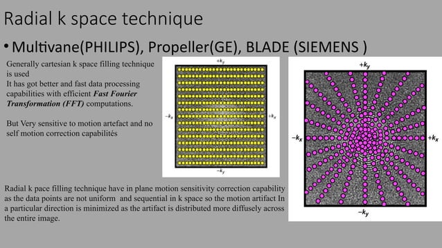 whole body MR Imaging and application.pptx