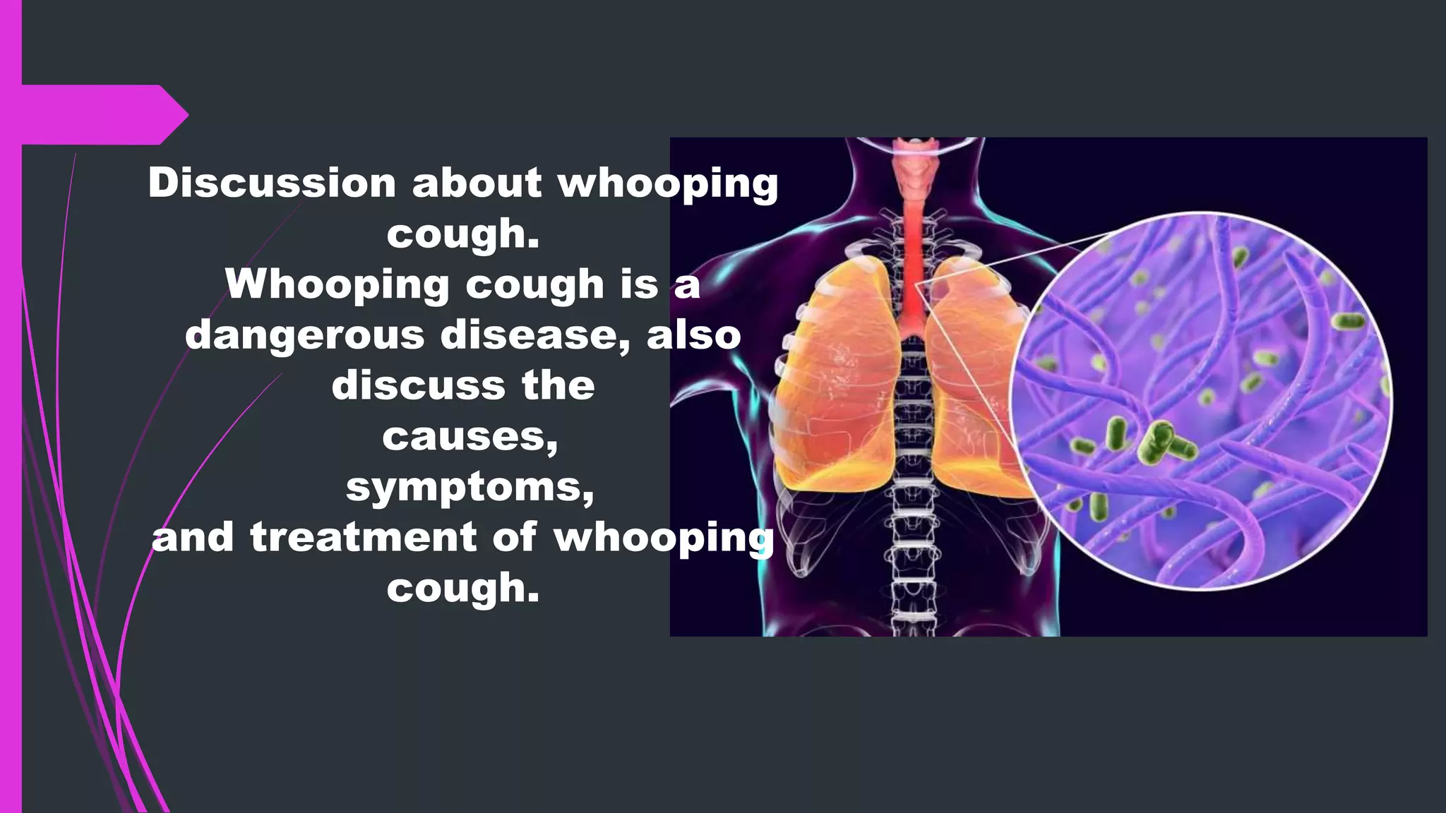 Whooping cough | pertussis ( medical information ) - a detailed study | PPT