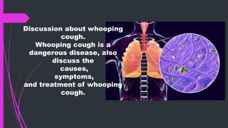 Whooping cough | pertussis ( medical information ) - a detailed study ...