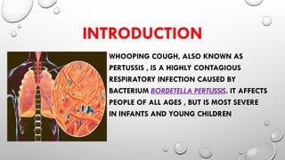 whooping cough community health nursing. | PPTX