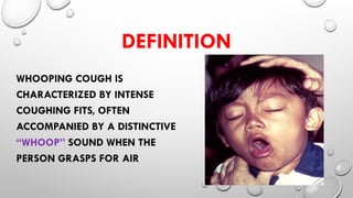 whooping cough community health nursing. | PPT