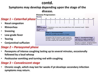 Whooping cough (pertusis) | PDF