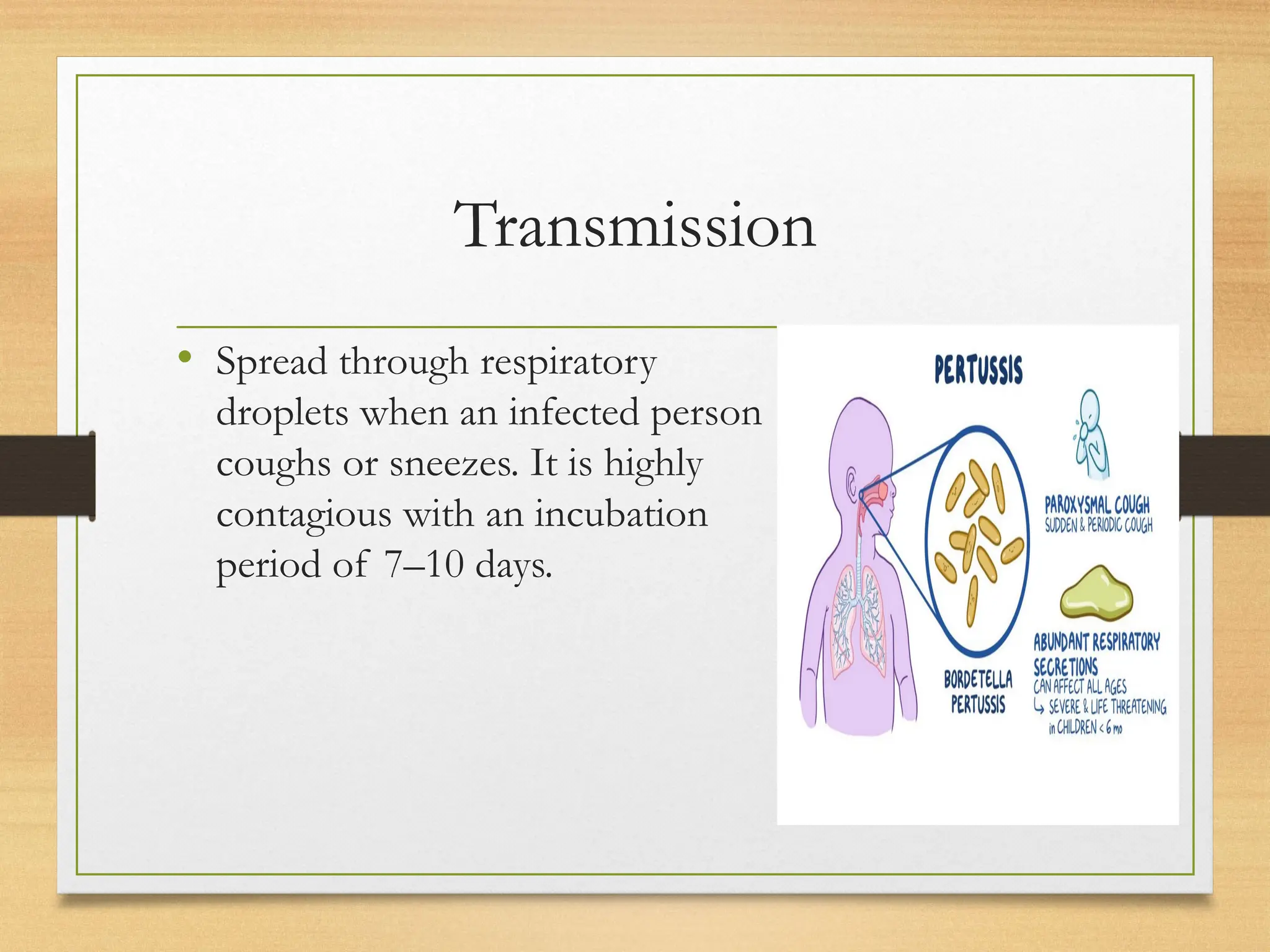 Whooping_Cough_Presentation didi.pptxbsbdbbfb | PPT