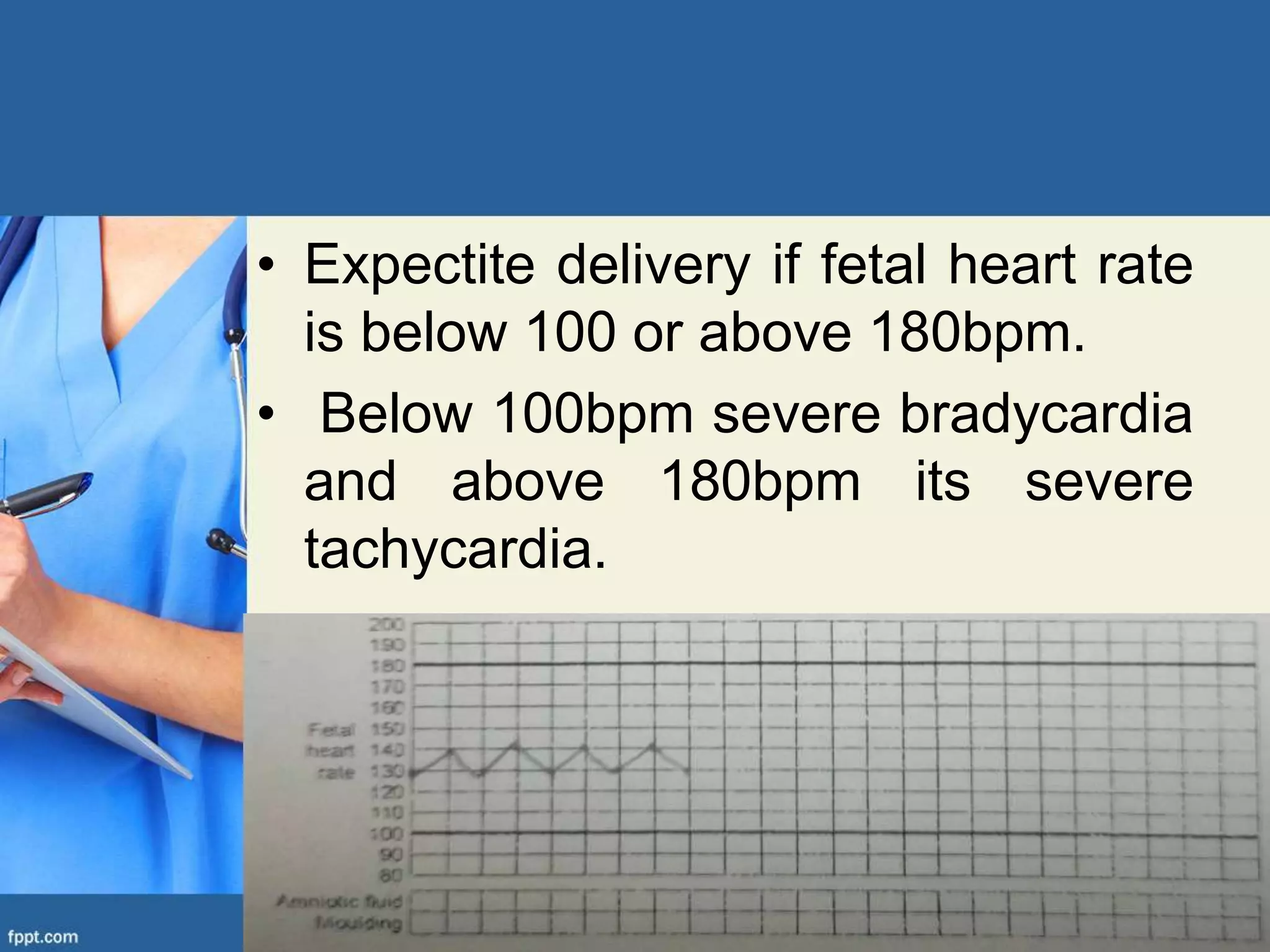 WHO partograph | PPTX