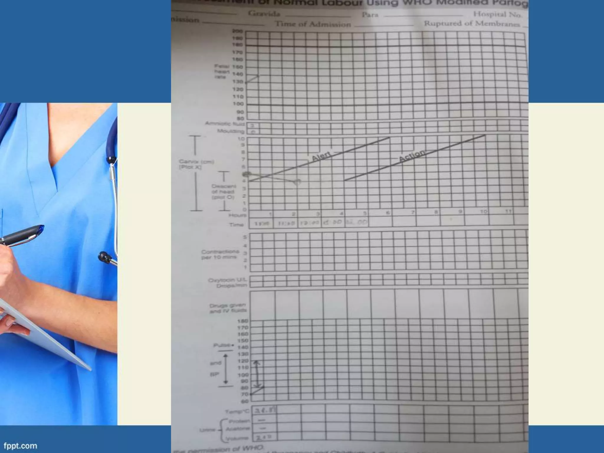 WHO partograph | PPTX