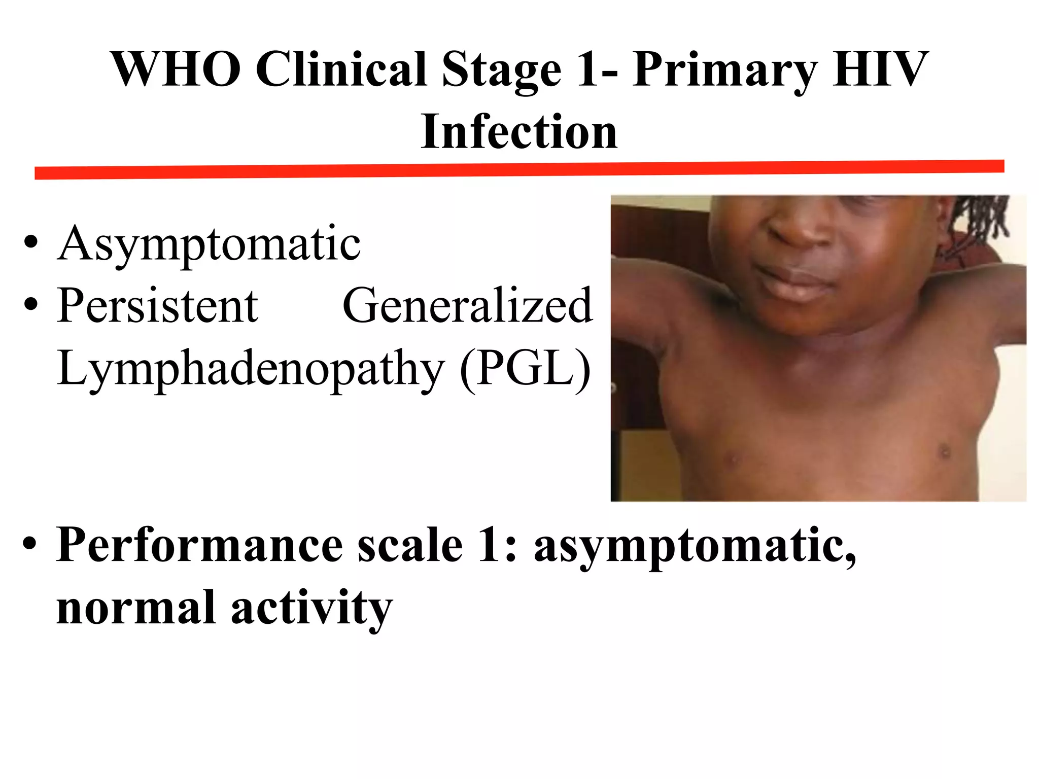 WHO Staging of HIV and AIDS.ppt