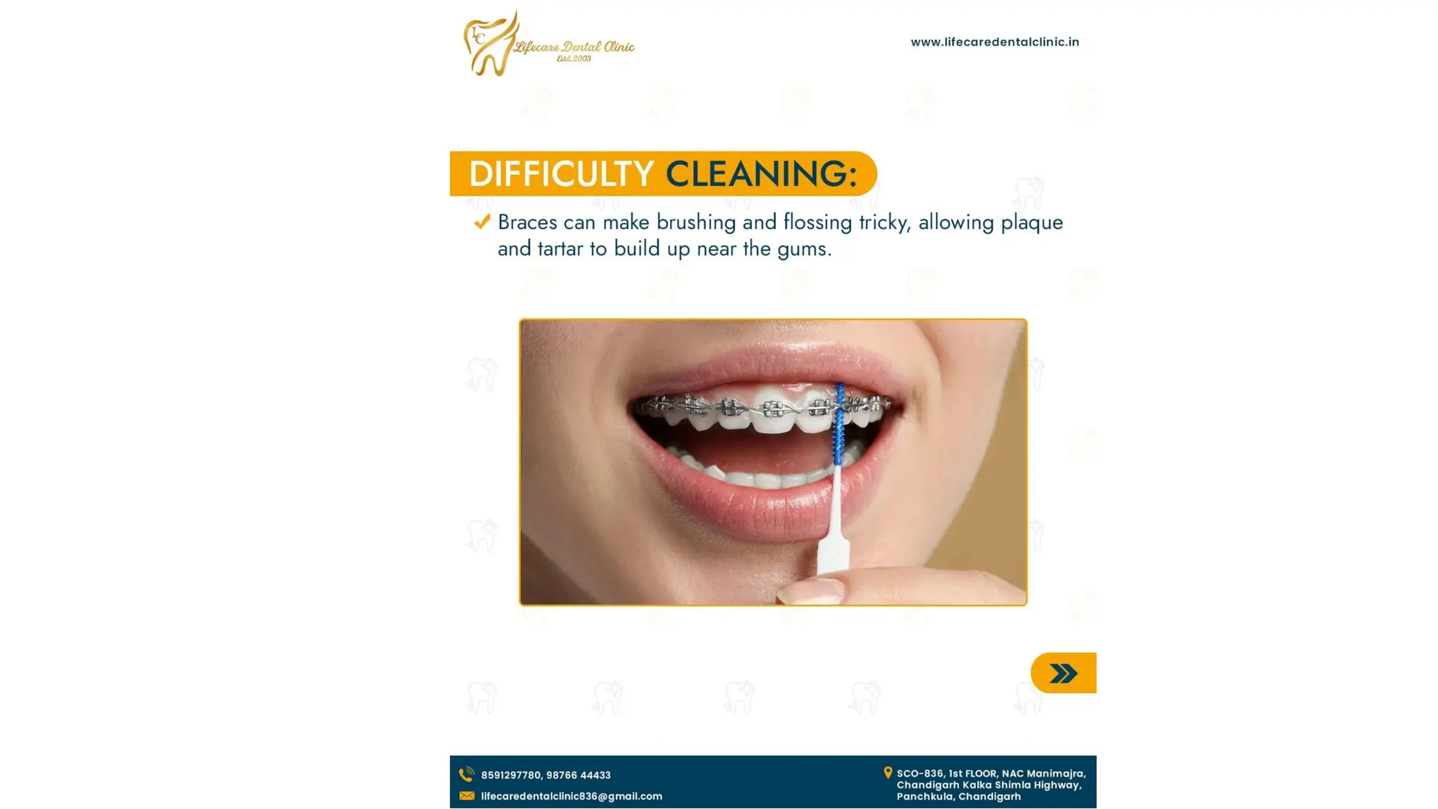 Why Are Braces and Gum Disease Linked? | Understanding the Connection | PPT