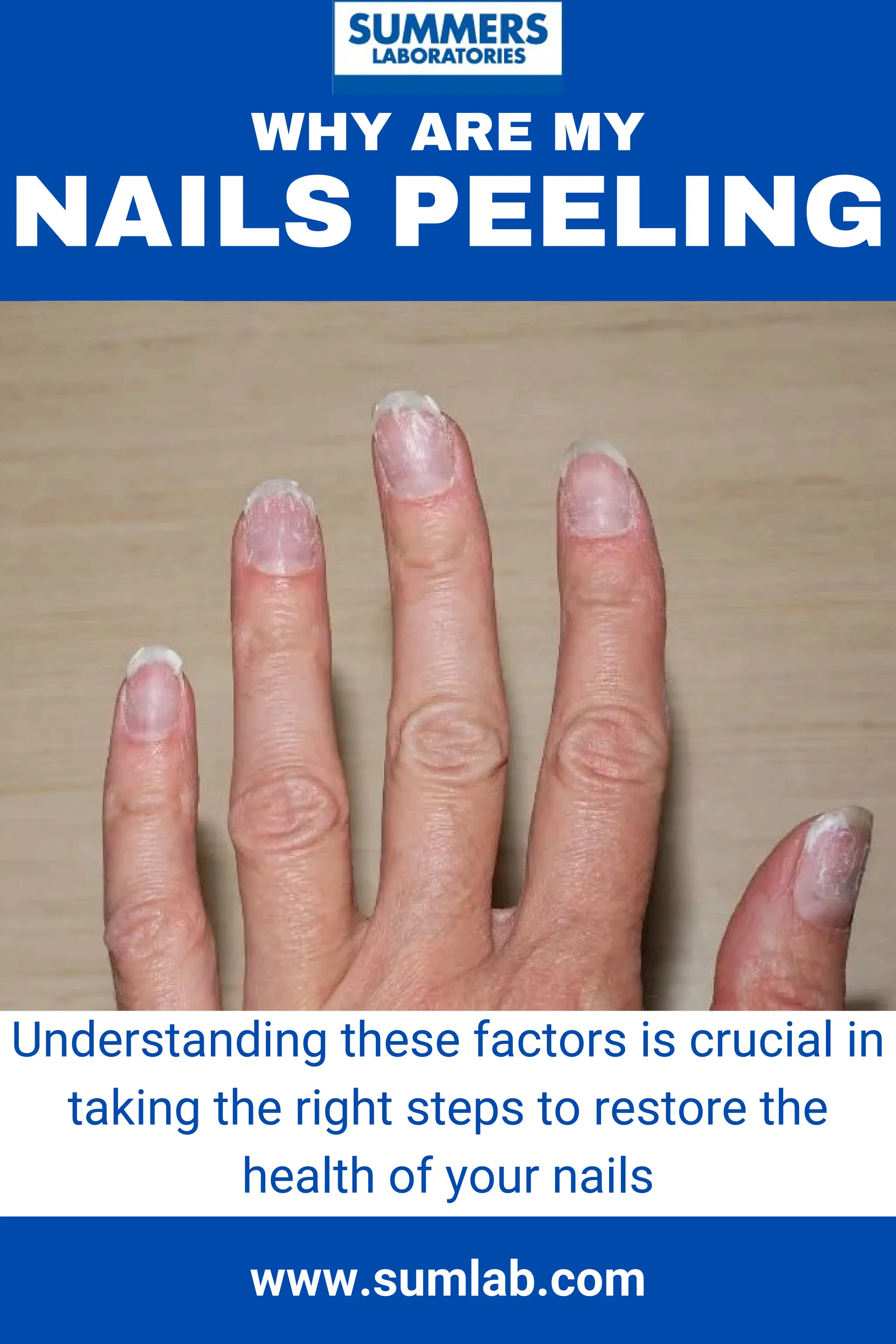 What does it mean when your fingernails are peeling? | PDF