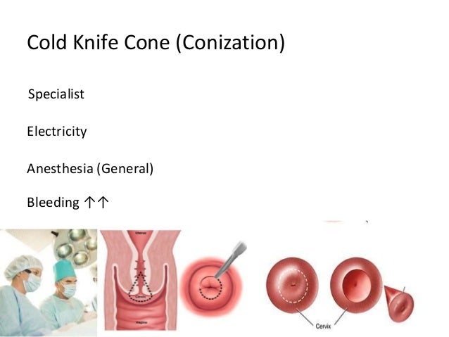 Why cervical cancer prevention need