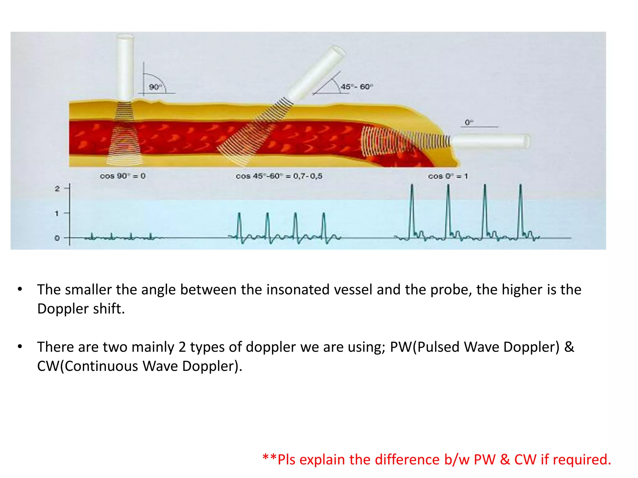 Why doppler ? | PDF