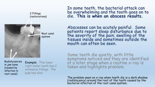 Why is a rct needed? | PPT