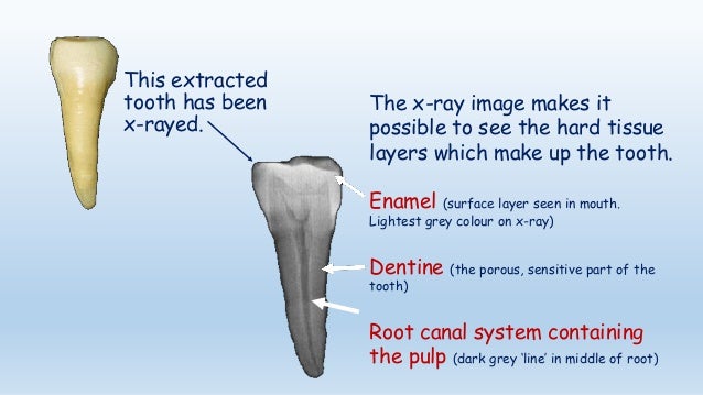 Why is a rct needed?
