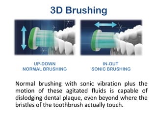 Why Oral SPA sonic toothbrush | PPTX