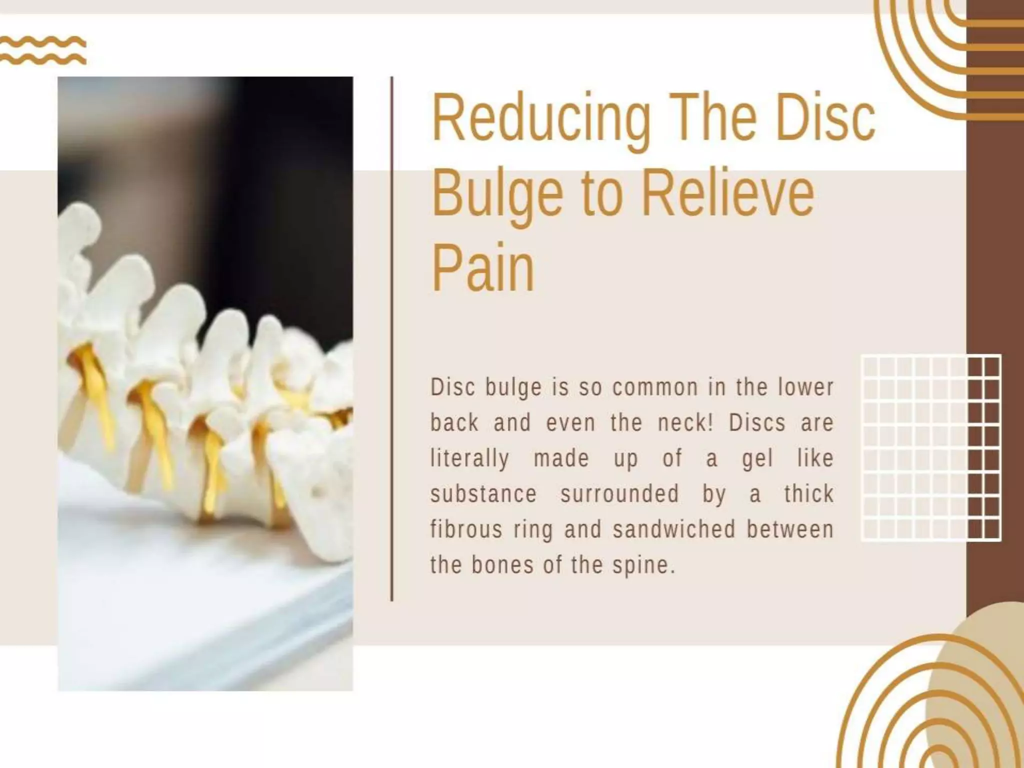 Why Physiotherapy is The Most Effective Treatment for A Disc Bulge ...