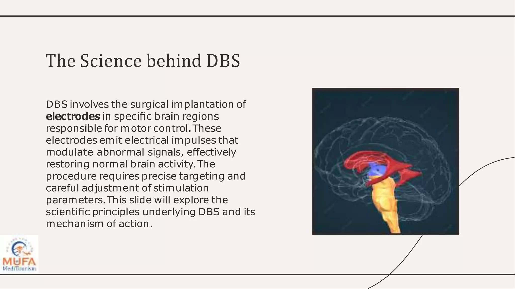 Why was Deep Brain Stimulation Introduced.pptx