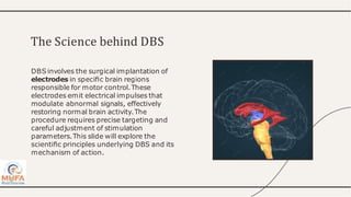 Why was Deep Brain Stimulation Introduced.pptx