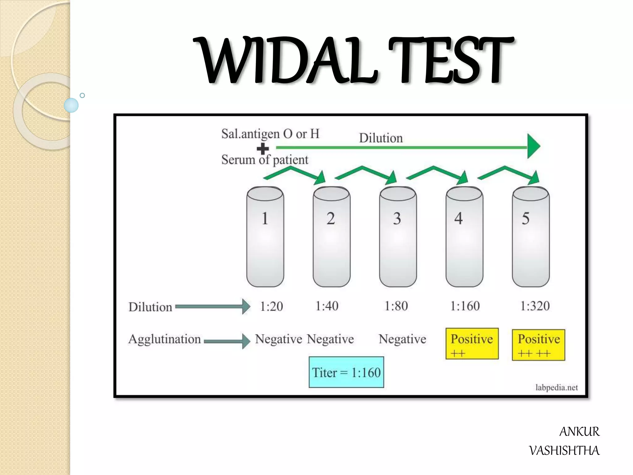 Widal Test | PPTX