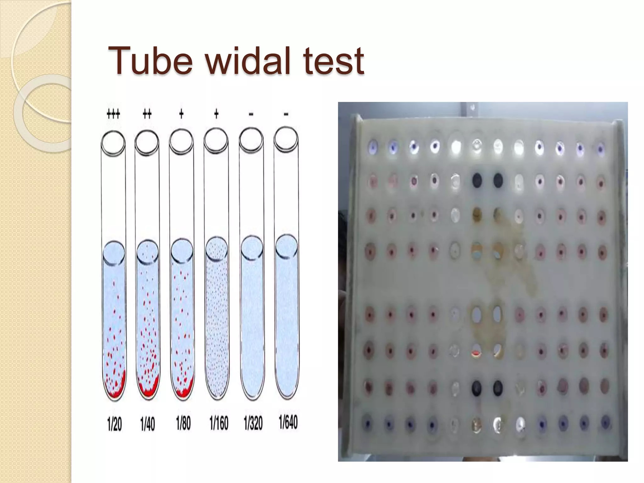 Widal Test | PPTX