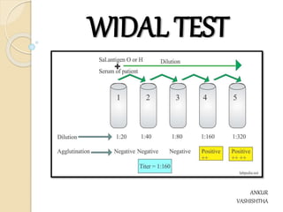 Widal Test | PPTX