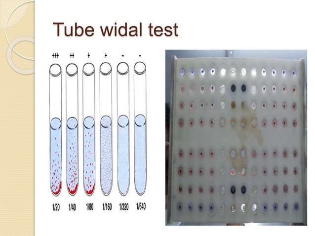 Widal Test | PPTX