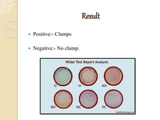 Widal Test | PPTX