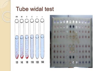 Widal Test | PPT