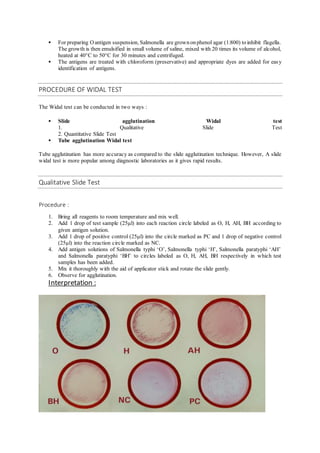Slide Agglutination Test Procedure