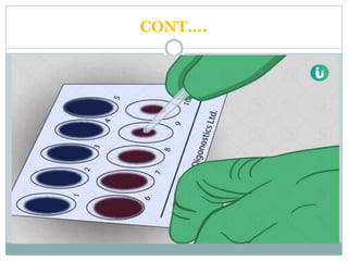 widal test. | PPTX