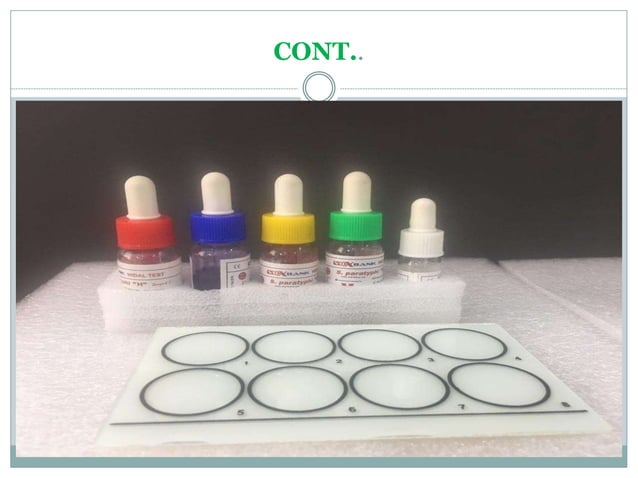 widal test. | PPTX