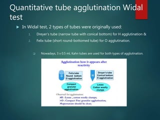 Widal test 3rd yr.pptx