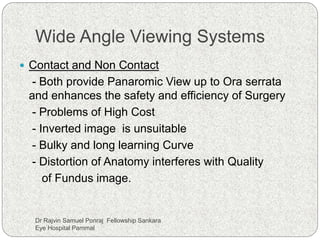Wide angle viewing field systems in vr surgery | PPTX
