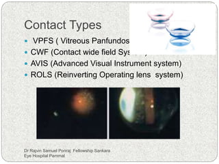 Wide angle viewing field systems in vr surgery | PPTX