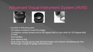 Wide angle viewing systems | PPTX