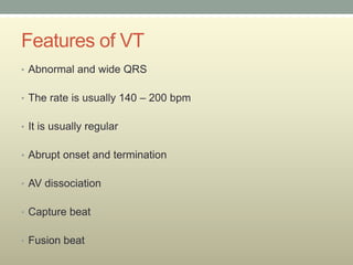 Wide complex tachycardia | PPT