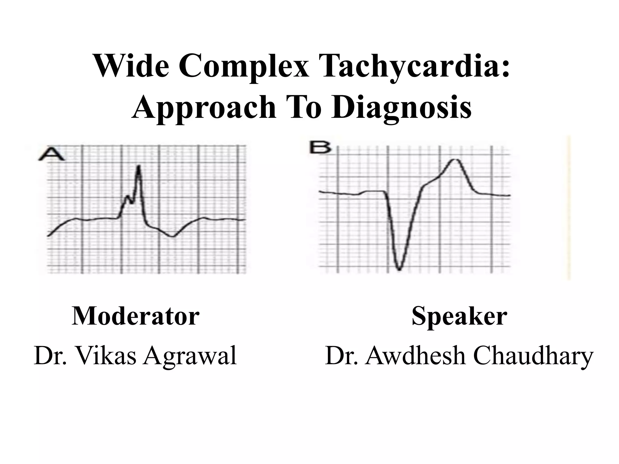 Approach to Wide complex tachycardia /cardiology | PPT