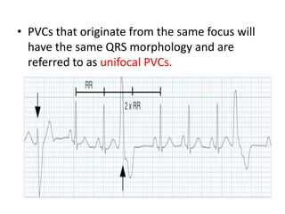 Approach to Wide complex tachycardia /cardiology | PPTX