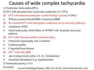 Approach to Wide complex tachycardia /cardiology | PPTX