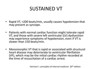 Approach to Wide complex tachycardia /cardiology | PPTX