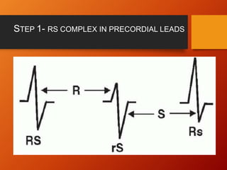 Wide QRS Tacycardia | PPT