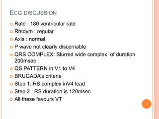 Wide complex tachycardia drneeraj | PPT