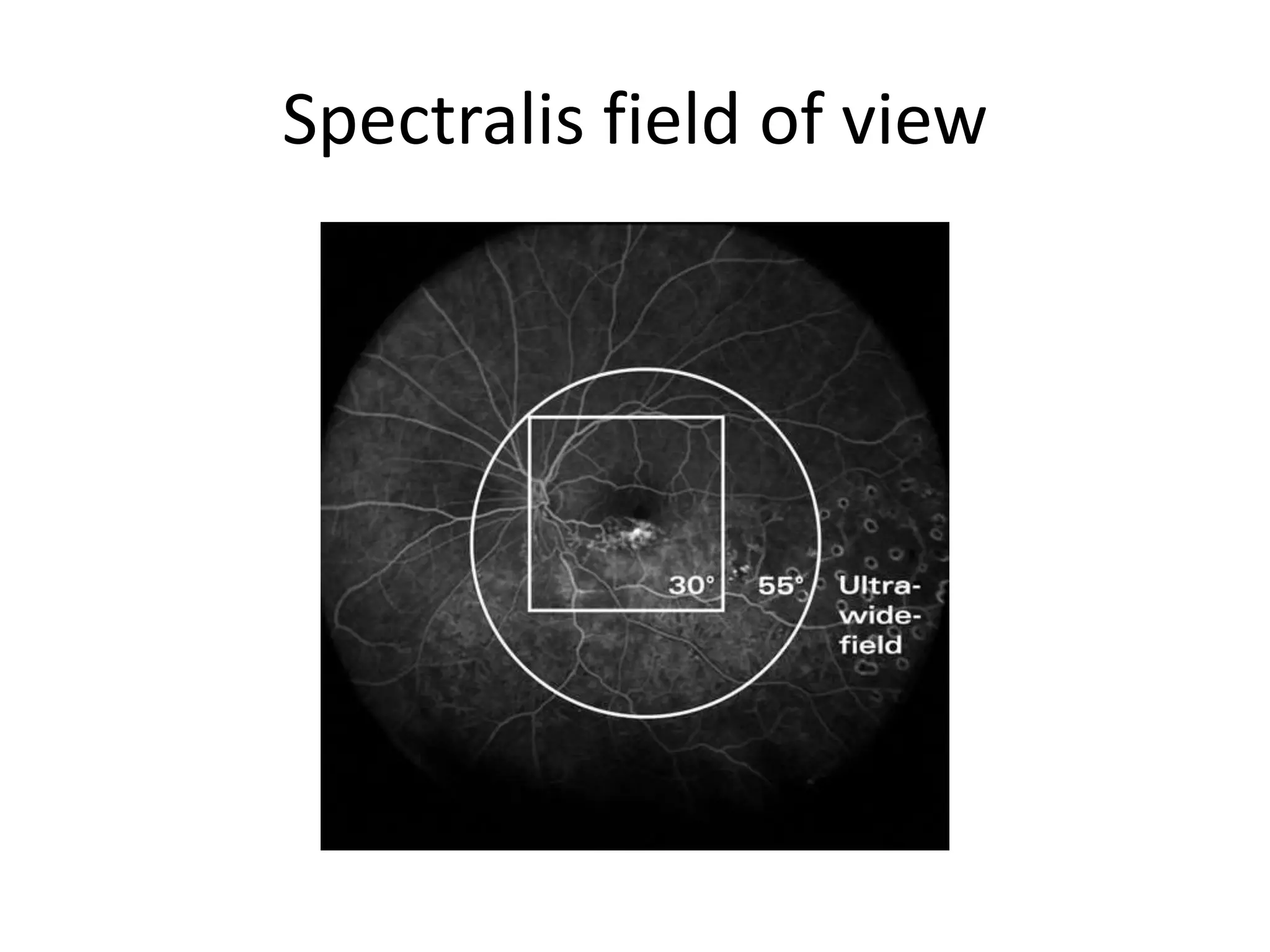 Wide field imaging in retinal pathology.pptx