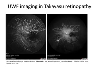 Wide field imaging in retinal pathology.pptx