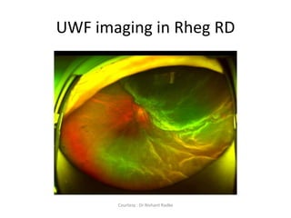 Wide field imaging in retinal pathology.pptx