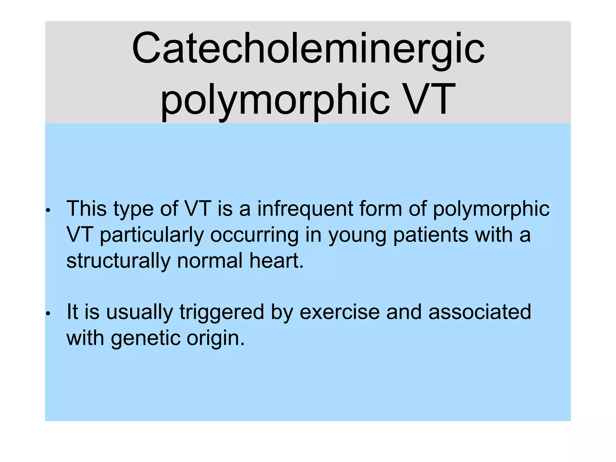 Irregular Wide Qrs Tachycardia Ppt 3471