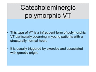 Irregular wide qrs tachycardia | PPT